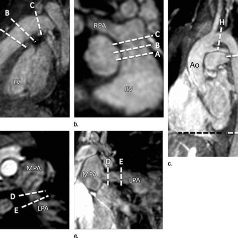 Example Of Correct Ecg Trigger Detection Cardiac Images Trigger