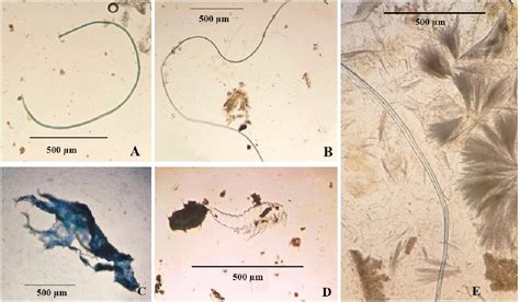 Figure 2 From Microfibers In The Gut Of Invasive Armored Catfish