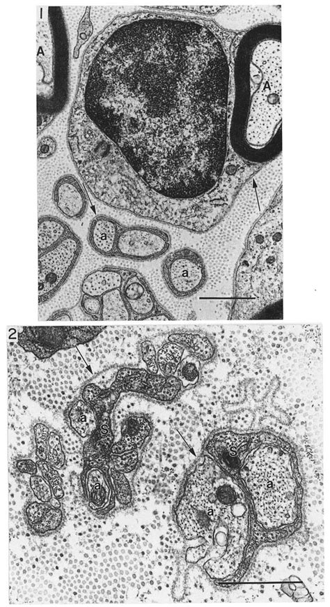 Nerve Regeneration After Simple Transection Of The Sciatic Nerve In