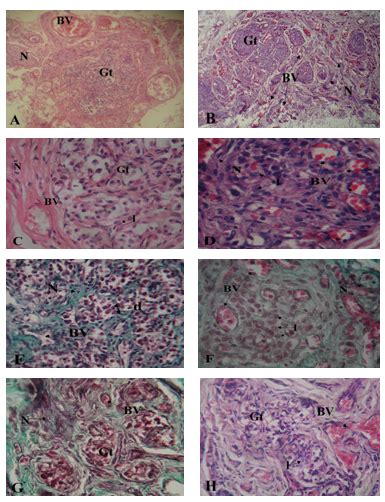 Sex Differences In Histomorphology Of The Human Carotid Body Medcrave