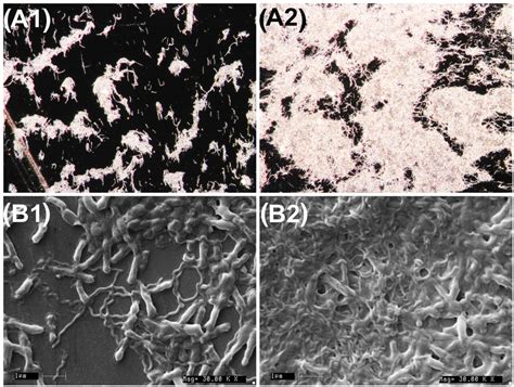 A1 And A2 Representative Dark Field Microscopy Images 20×