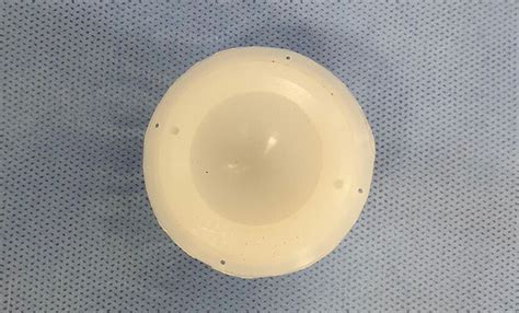 Example Of An All Polyethylene Acetabular Component Download Scientific Diagram