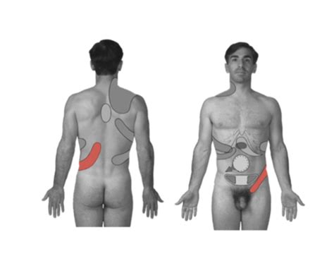 26 Urinary Incontenance And Altered Voiding Flashcards Quizlet