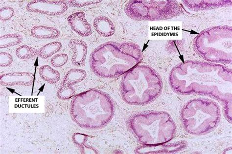 Efferent Ductules