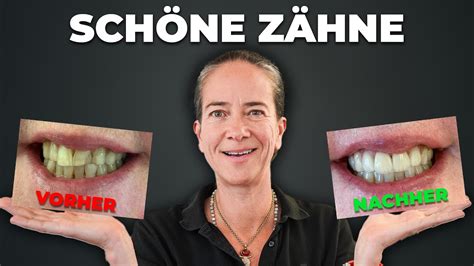 Endlich Schöne Zähne Die Schnelle Lösung Für Dein Perfektes Lachen