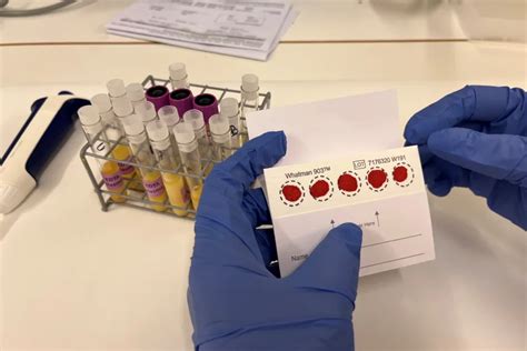 Metabolomics Can Contribute To Faster Drug Development Nortrials