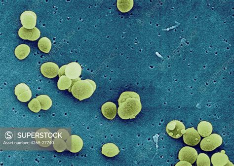 Staphylococcus Aureus Color Ehanced Scanning Electron Micrograph Sem