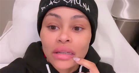 Blac Chyna Warns Fans Over Fillers Saying She Looked Crazy With