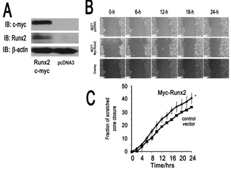 Runx2 Expression Increases Cell Migration In Non Metastatic Mcf7 Breast
