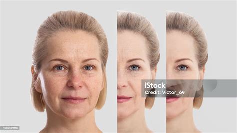 화장하지 않은 얼굴 중년 클로즈 업 여자 얼굴 전에 화장품 후 주름이 있는 얼굴을 위한 스킨 케어 노화 방지 페이스 리프트 트리트먼트 전 페이셜 스킨케어 및 컨투어링 전후에