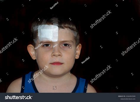 Forehead Bleeding Blood Clots This Is The Face Of Someone Exhausted