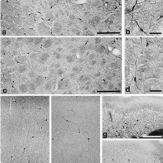 Differential Interference Contrast Microphotographs Of Some Download Scientific Diagram