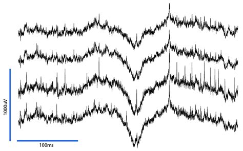 tetrode recording example — open ephys