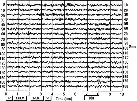 A 3 Min 180 Sec EEG Signal Recorded From Subject A Sampling Rate Download Scientific