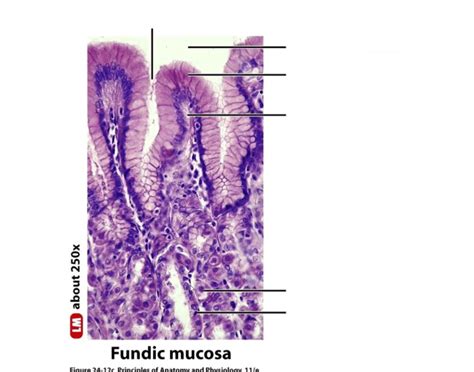 Fundic Mucosa Quiz