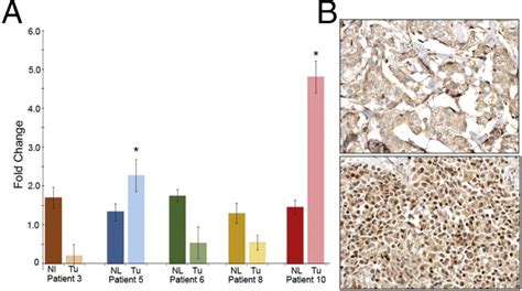Macrod2 Overexpression Mediates Estrogen Independent Growth And