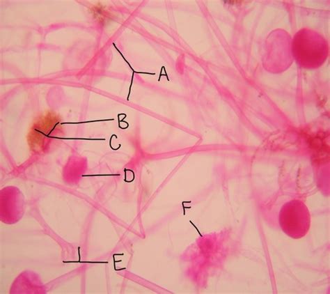 Microbiology Fungi Lab Flashcards Quizlet