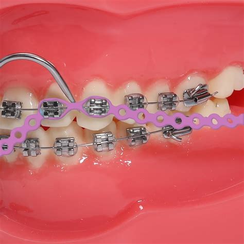 Braces Chain Colors Continuous Power Chains – Cx Orthodontic Supply