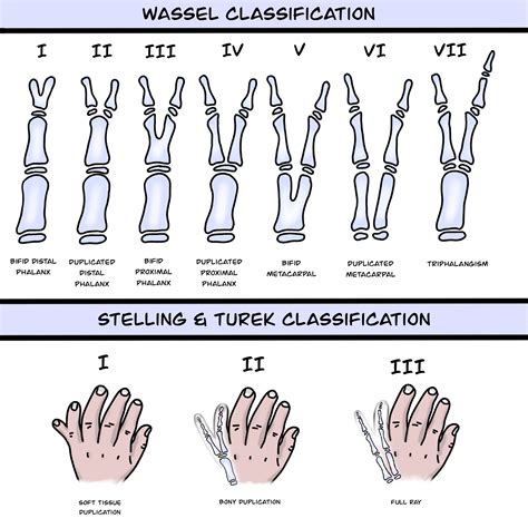 Supernumerary Digit Treatment And Management Point Of Care