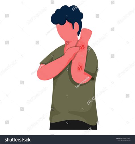 1,180 Eczema Prevention Images, Stock Photos & Vectors | Shutterstock