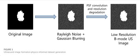 Figure 1 From Medical Ultrasound Image Speckle Reduction And Resolution