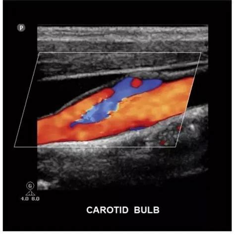 Philips Clearvue 550 Ultrasound Machine At ₹ 2500000 In Ahmedabad Id 23108744788