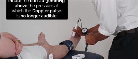 Abpi Measurement Ankle Brachial Pressure Index Osce Guide
