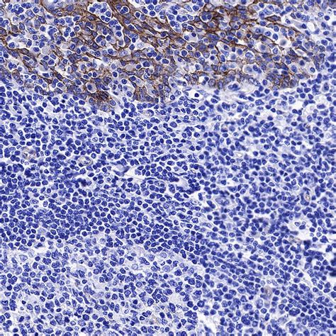 β Catenin Recombinant Rabbit Mab Sdt 336 23p35222斯达特公司官网