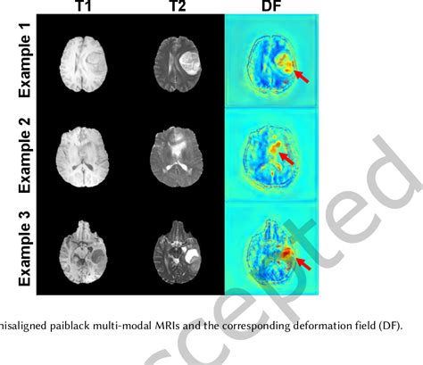 Figure 1 From Dbgan Dual Branch Generative Adversarial Network For Multi Modal Mri Translation