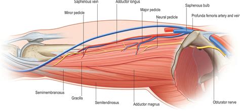 Free Functioning Muscle Transfer Clinical Tree