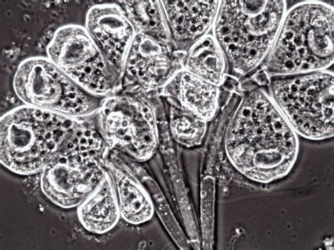 Stalked Ciliates