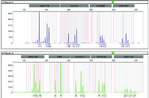 Another Mixed Profile In Autosomal STR Male And Female By Using Download Scientific Diagram