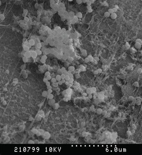 Sem Image Of Methicillin Resistant Staphylococcus Pseudintermedius