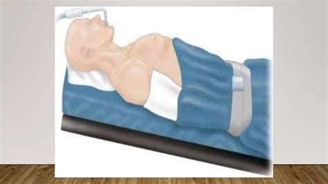 Anterior Cervical Corpectomy Pptx