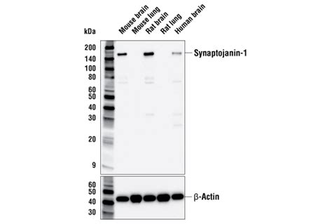 Synaptojanin 1 Antibody Cell Signaling Technology