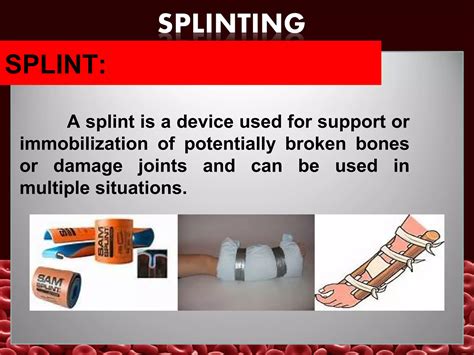 Bandagingandsplinting Ppt
