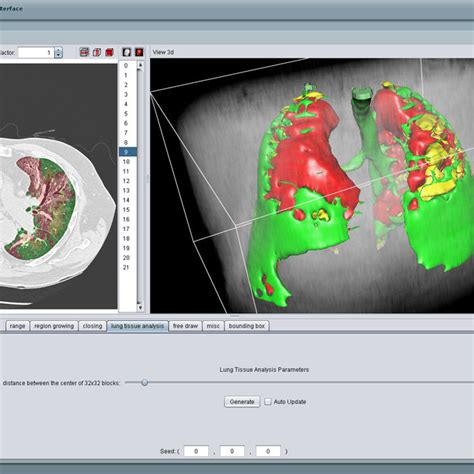 Combination Of Data Representation Techniques In Visual Retrieval