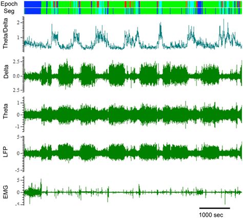 Representative Example Of Sleep Staging In A Young Adult Using Spike2s