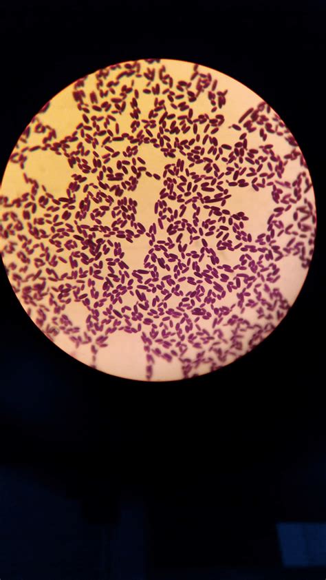 68 Questions With Answers In Microorganism Identification Science Topic