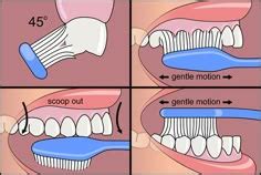 Modified Bass Technique How To Brush Your Teeth Properly Brushing