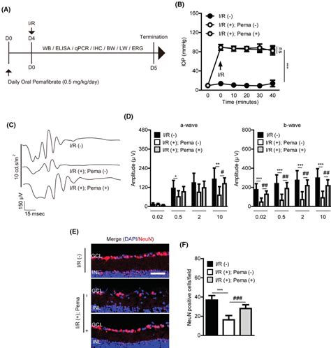 Retinal Damages In A Mouse Model Of Retinal Ischemiareperfusion Ir