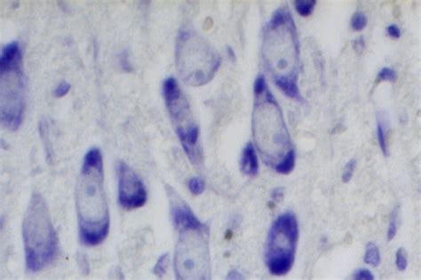 Nissl Staining Nissl Staining An Overview Sciencedirect Topics Nissl Staining Nissl Staining An Overview Sciencedirect Topics
