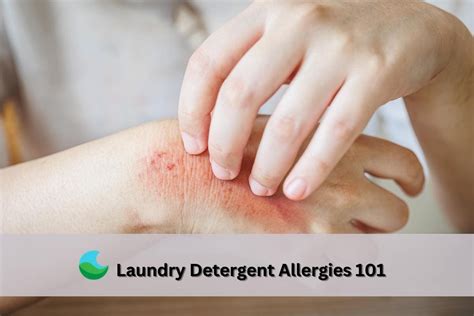 Causes And Management Of Laundry Detergent Allergies Tips For Allergic