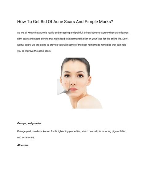 Ppt How To Get Rid Of Acne Scars Powerpoint Presentation Free