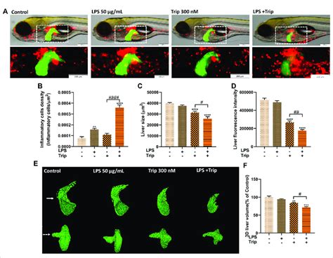 The Effect Of Triptolide On The Inflammatory Cells And Liver Morphology
