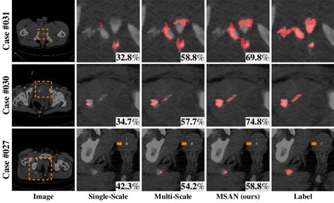 Qualitative Comparison Of Different Methods From Left To Right Download Scientific Diagram