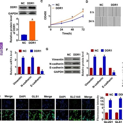 Expression Of Ddr1 In Hcc Tissue And Cells A The Expression Of Ddr1 Download Scientific