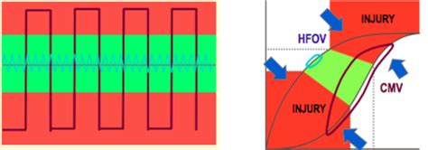 Hf Oscillator Flashcards Quizlet