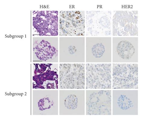 breast cancer organoids recapitulate the histological heterogenicity of
