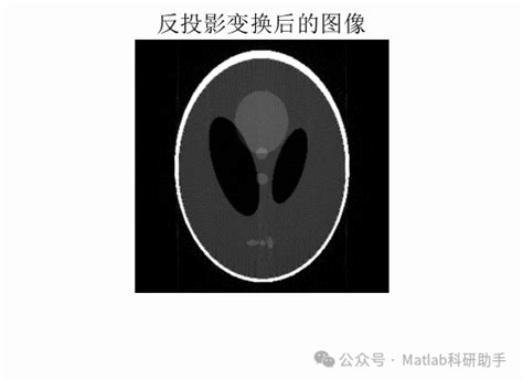 【图像重建】使用fdk的三维谢普洛根幻影重建附matlab代码 katsevich算法 csdn博客